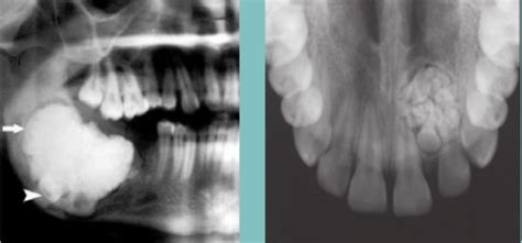 Developmental Abnormalities Flashcards Quizlet