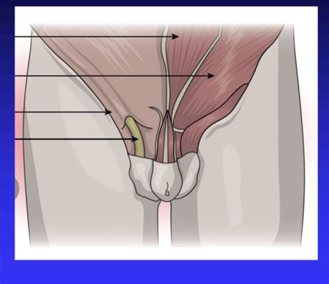 A Lump In The Groin Flashcards Quizlet