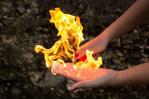 Too Hot To Handle Benefits Of Hand Therapy For Burns Spooner Physical Therapy