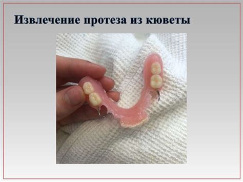 Изготовление съемных пластиночных протезов презентация онлайн