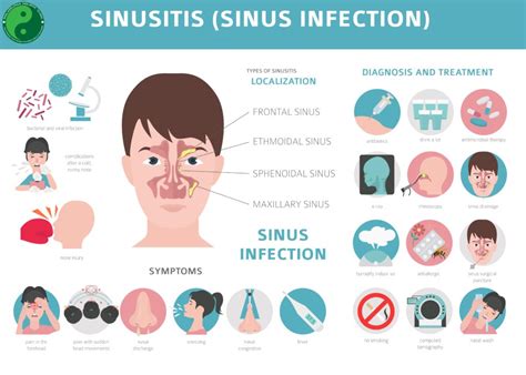 Sinusitis Antibiotics Guidelines
