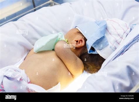 Neonatal Jaundice Newborn Was Therapy By Phototherapy Blue Light