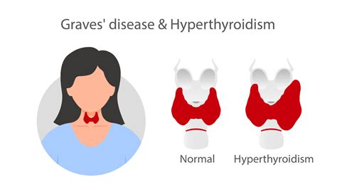 Clinical Applications And Scenarios Of Trab Mindray