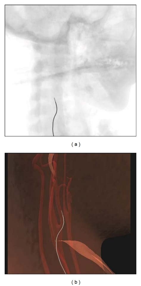 Visualization Of Our Simulator A Fluoroscopic View To Simulate The