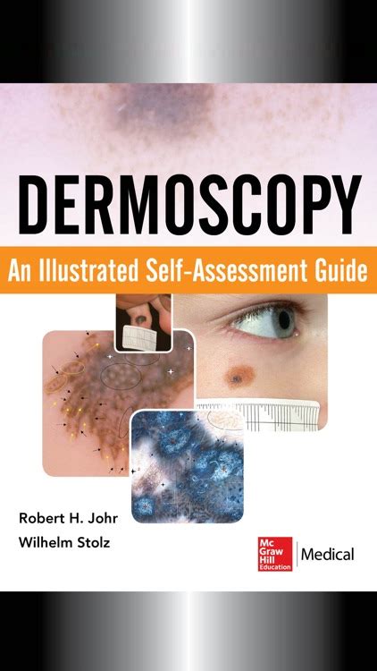 Dermoscopy Self Assessment By Usatine And Erickson Media Llc