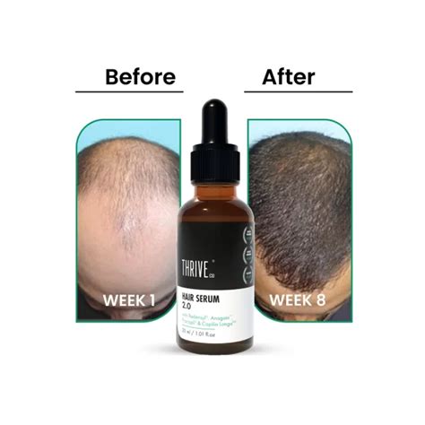 Thriveco Hair Growth Serum 20 With Redensyl 30ml Cureka