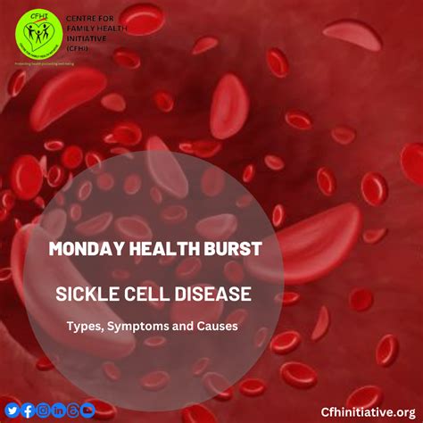 Monday Health Burst On Sickle Cell Disease Types Symptoms And Causes