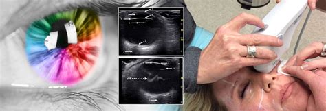 Eye Ultrasound Eye Test Radiology Clinic In Nagpur
