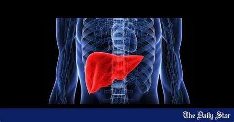 Liver Cancer Detection Trial On New Test In Bangladesh Shows Promising