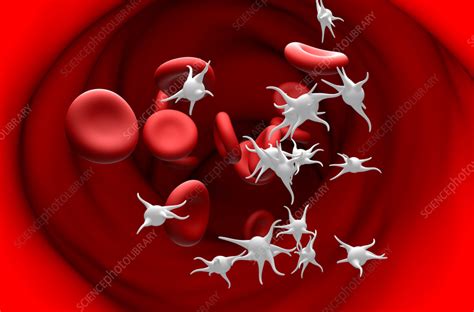 Essential Thrombocythaemia Illustration Stock Image F040 0849 Science Photo Library