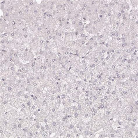 Anti Cdh17 Antibody Produced In Rabbit