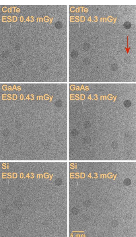 Contrast Comparison Of The Commercial Phantom With Cdte Gaasand Download Scientific Diagram