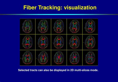 Ppt New Progresses Of Dti Map A Program For Dti Computation And