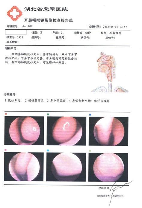清鼻堂 鼻炎的诱因症状跟治愈方式 清鼻堂官网 清鼻堂品牌鼻炎店 鼻炎 鼻窦炎 乔竺清鼻堂
