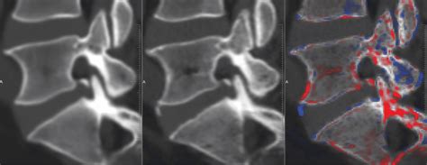 Deep Learning Demystified Why Testing Is The Key To Success Mriguidance