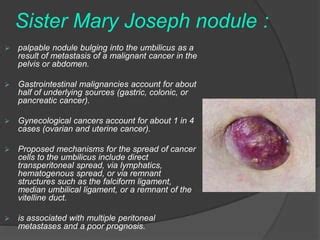 Diseases Of The Umbilicuspptx