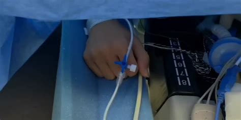 Sseps Meps Ssep Ionm Meps Sseps Intraoperativeneuromonitoring