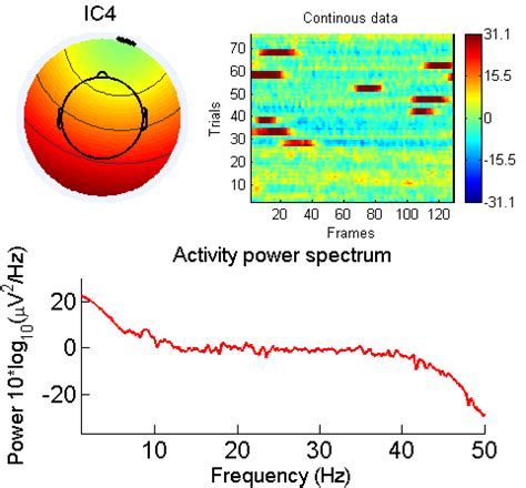 Scalp Map Component Activity And Power Spectrum Of The Independent Download Scientific Diagram
