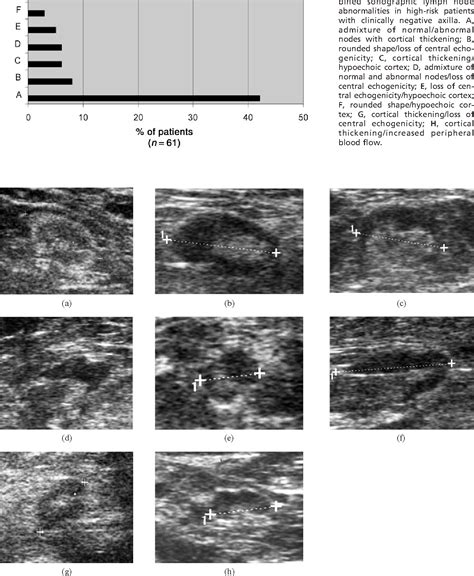 Cortex Of Lymph Node Semantic Scholar