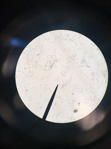 Sperm Slide Flashcards Quizlet