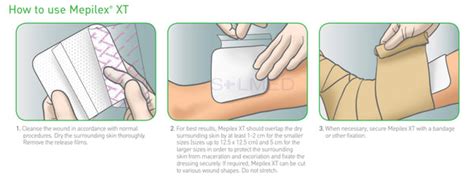 Mepilex Xt Foam Dressings Solmed Medical Supplies Solmed Online