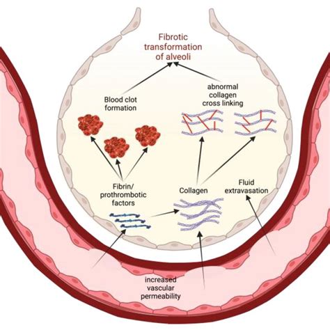 A Model For How Increased Vascular Permeability Can Potentiate Fibrotic