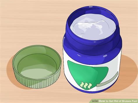 How To Get Rid Of Bruises Fast Steps With Pictures WikiHow