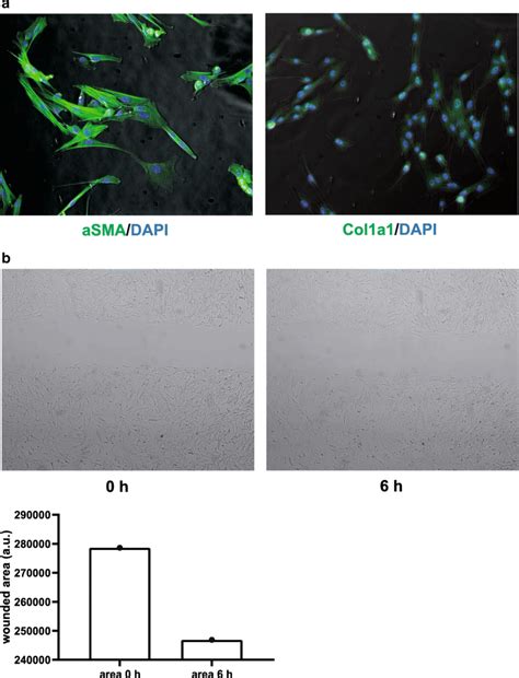 Characterization Of Porcine Aortic Valve Interstitial Cells Avic A