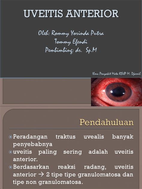 Uveitis Anterior Pdf