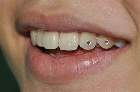 Small Tooth Gems Flexmatter