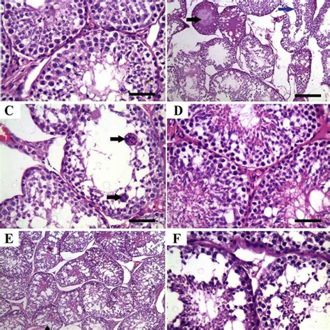 Representative Photomicrograph Of Testicular Tissues Of Rabbits From