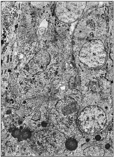 An Electron Micrograph Of Spermatogenic Cells From A Normal Rat Testis Download Scientific