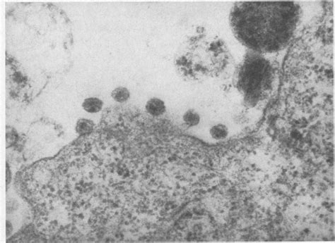 The Transmission Electron Micrograph Shows Human Immunodeficiency