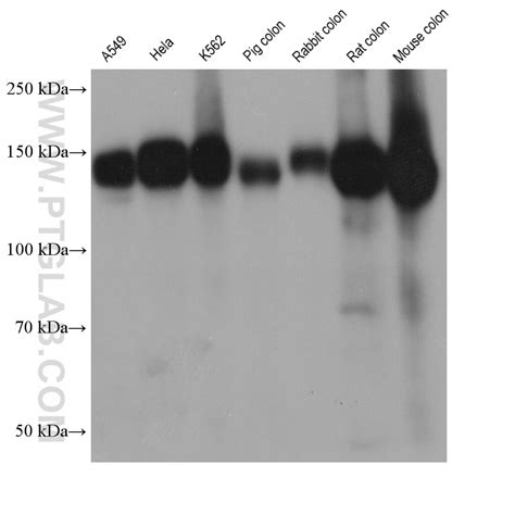 Integrin Alpha 5 Cd49e Antibody 68561 1 Ig Proteintech 武汉三鹰生物技术有限公司
