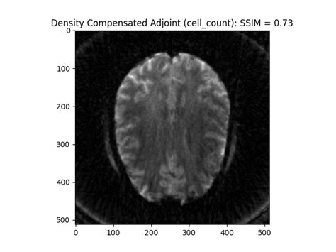 GPU Density Compensation Reconstruction Comparison Pysap V0 2 1