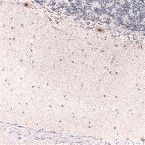 Mouse Monoclonal Anti Msh3 Antibody Buy For Research Highly