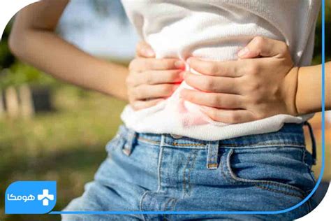 سندروم روده تحریک پذیر چیست؟ مجله هومکا