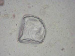 Cestodes And Trematodes In Biology Flashcards Quizlet