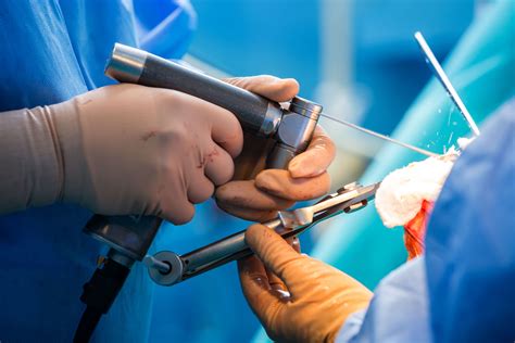 Tibial Tubercle Osteotomy
