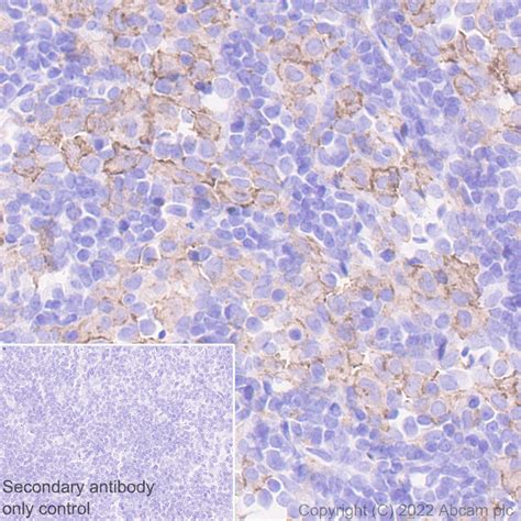 Antigen Retrieval 100x Tris Edta Buffer Ph 9 0 125 250 Ml Ab93684