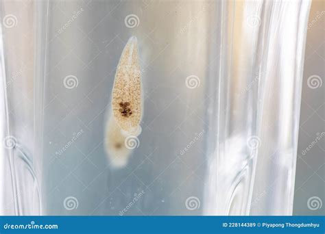 The Study Parasite Or Worms Is A Freshwater Fish Parasite In Laboratory