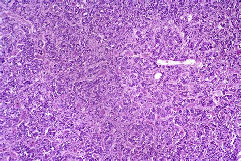 Microscopic Structure Of Posterior Pituitary Gland