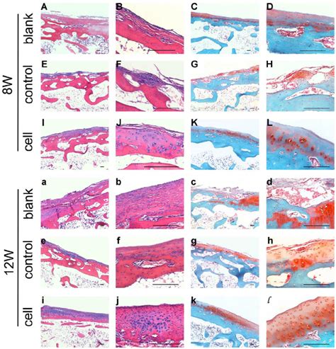 Histological Evaluation Of Scaffolds And Ipscs In The Restoration Of