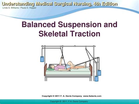 Skeletal Traction Client Education At Tina Lown Blog