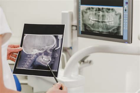 Tmj Treatment Rocky Hill And Bristol Ct Oral Surgeon