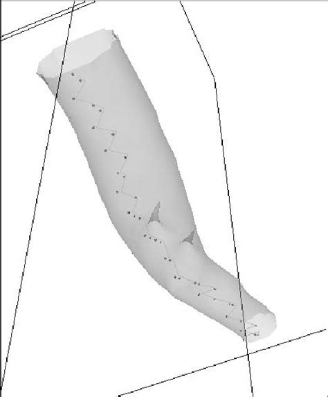 Centerline Detection For Simple Non Bifurcating Tubular Structure Download Scientific Diagram