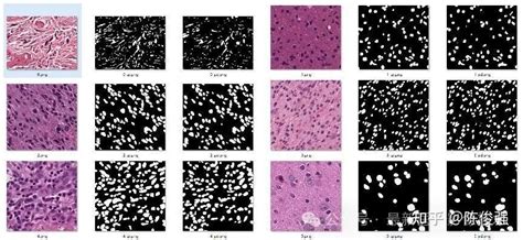 Monuseg2018——多个器官病理组织图像核分割 知乎