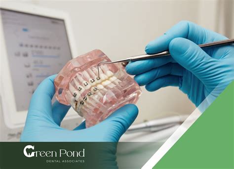 Are Ceramic Braces Right For You Benefits And Treatment