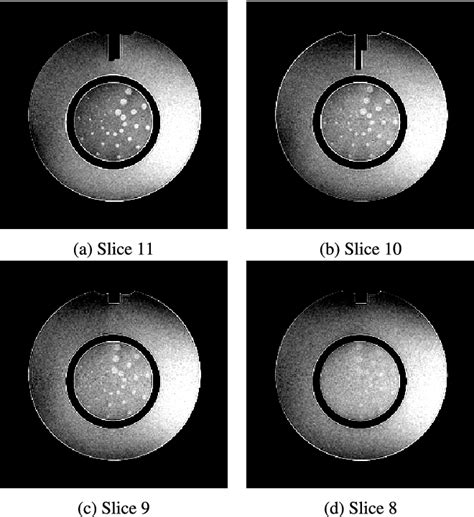 Figure 2 From Using Convolutional Neural Network To Automate Acr Mri Low Contrast Detectability