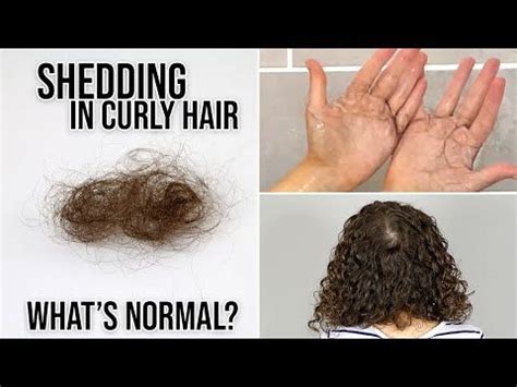 Shedding What S Normal Causes How To Reduce Shedding Artofit